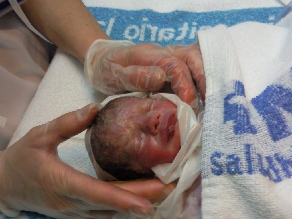 PARTO ASINCRÓNICO EN LA GESTACIÓN MÚLTIPLE - Dra de la Calle | María de ...